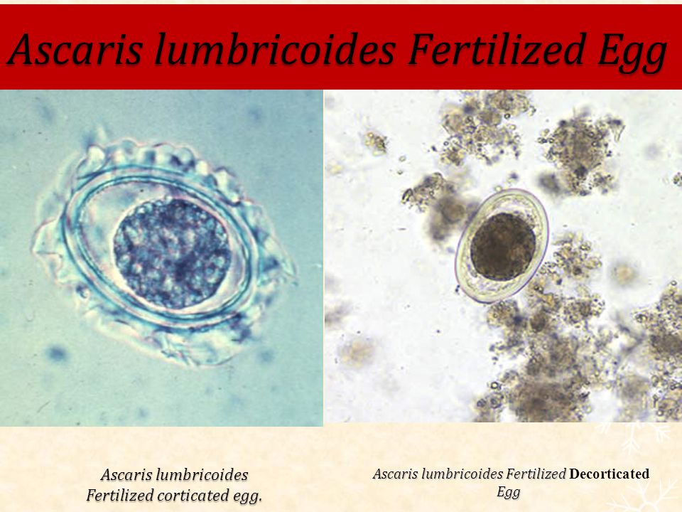 Lecture Notes in Medical Technology: Lecture #2: THE INTESTINAL NEMATODES