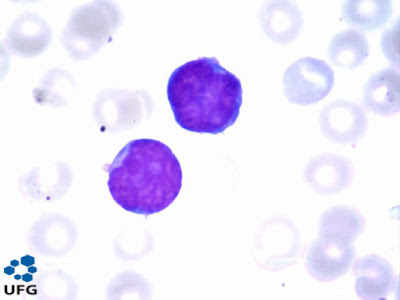 Hematología: Leucopoyesis