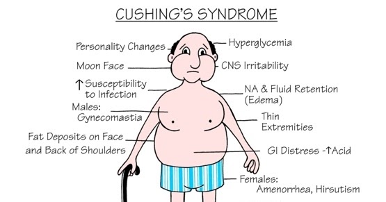 Prepare for Medical Exams : Regarding Cushing Syndrome answer the ...