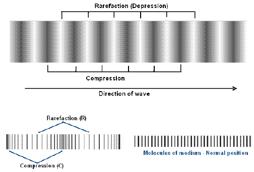 APS, Golconda | Priyanka Gupta: class 9 / physics / sound / QUICK BITS