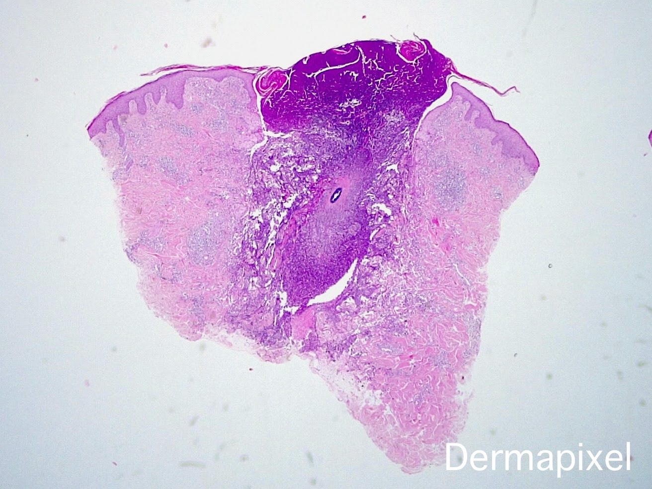 Dermapixel: abril 2020