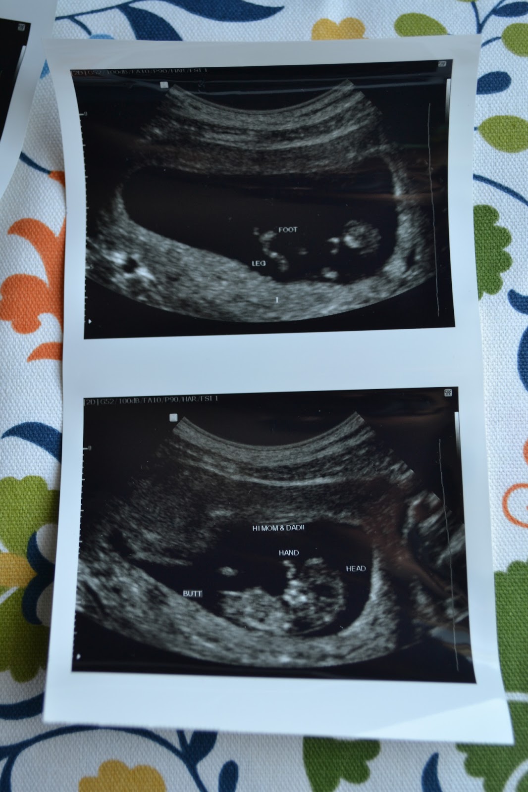 The Baker Bustle: Guess Whaaaaaaaaat!!!