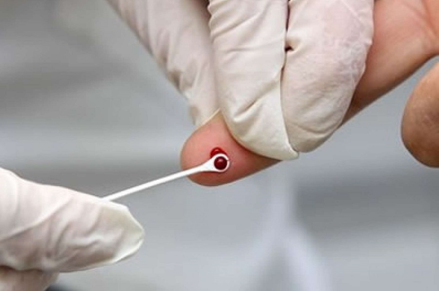 Unidade De Saúde Sesp Está Disponibilizando Teste Rápido Para Detectar