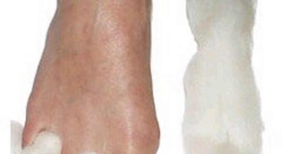 Atlas Biomechanics : Lamb's Wool for Toe Cushioning