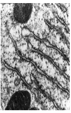 Histología Pa La Banda: Ribosomas y Reticulo Endoplasmico Rugoso