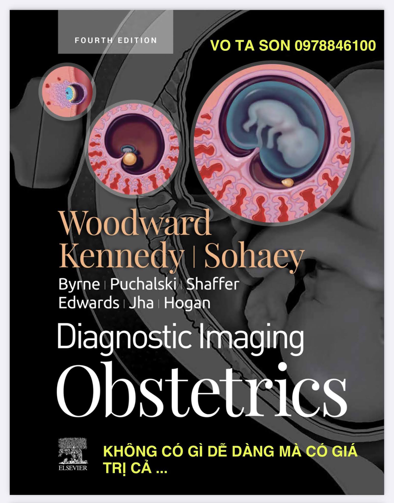 Bác Sĩ Võ Tá Sơn: Siêu phẩm 2021: Atlat siêu âm sản khoa của GS Paula J. Woodward tái bản lần thứ 4