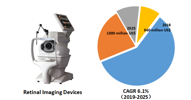 Global Retinal Imaging Devices market will reach 1300 million US$ by ...
