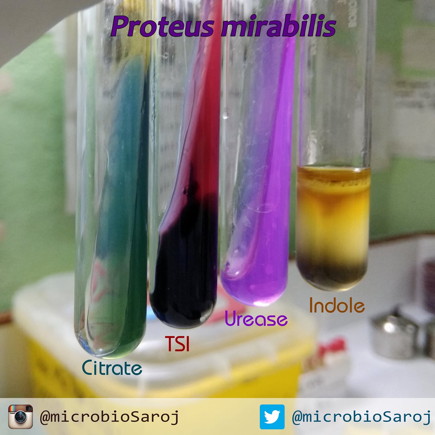 MICROBIOLOGY BLOG FOR STUDENTS (MBLOGSTU): Cultural and Biochemical ...