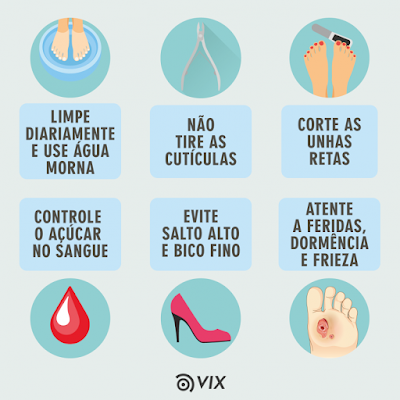 Pé Diabético - Prevenção, Sintomas, Causas e Tratamento - Como Cuidar ...
