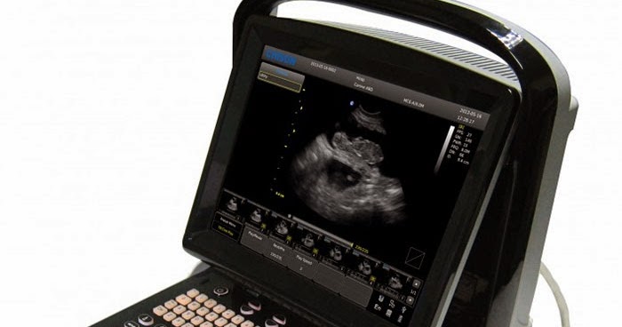 CV. ANDI JAYA: Alat USG B/W Ultrasound CHISON