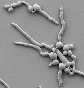 jamur oncom ( MONILIA SITOPHILA ) | Nita Prabawati Kennedy
