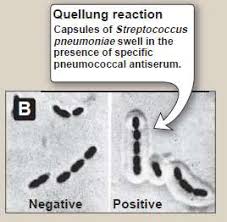 EXAMS AND ME : Quellung Reaction