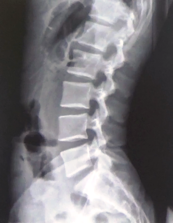 RADIOANATOMIA: CLASE 9