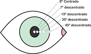 Optometria em Foco: Teste de Hirschberg
