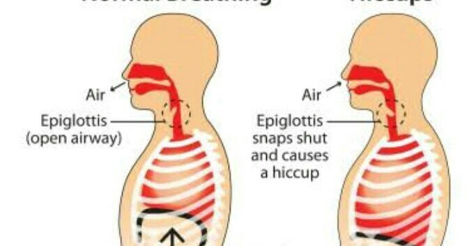 DaySpring Health Care: ADULT HICCUPS