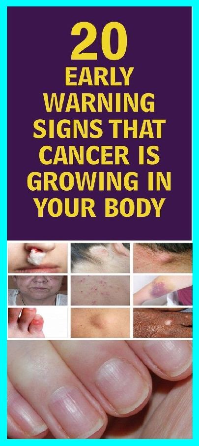 Recognize The Early Symptoms And Save Your Own Life: 20 Signs That A ...