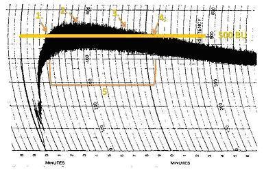 Learn Flour Quality: Farinograph