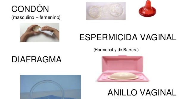 Conociendo los Métodos: Métodos de Barrera