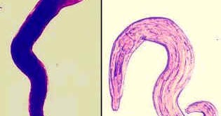 Enterobius vermicularis