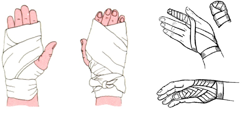 PROTOCOLO DE PRIMEROS AUXILIOS "VENDAJES": VENDAJE PARA MANO Y DEDOS