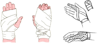 PROTOCOLO DE PRIMEROS AUXILIOS "VENDAJES": VENDAJE PARA MANO Y DEDOS