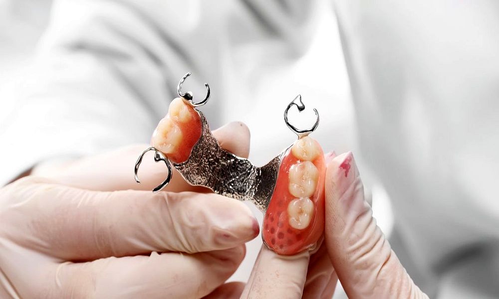 O que é uma prótese parcial removível? | Directorio Odontológico