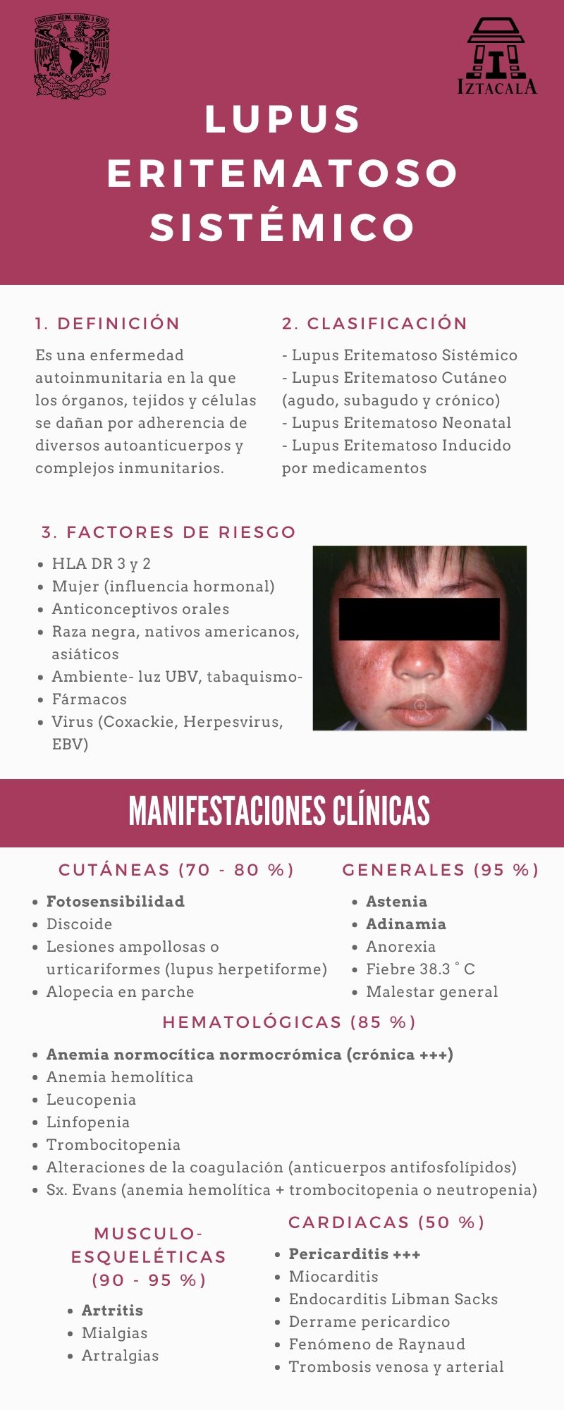 LUPUS ERITEMATOSO SISTEMICO