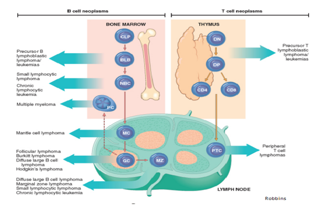 Pathology Cases: lymphoma review