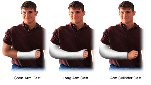 runforlife: ใส่เฝือกอยู่จะวิ่งได้มั้ย