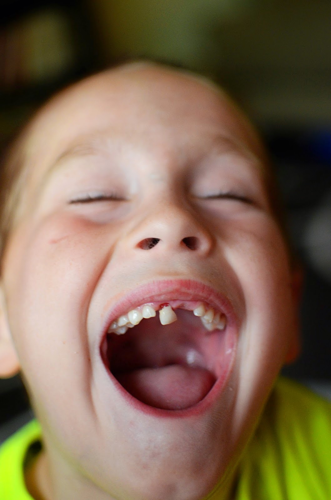 Adventures in Japan!: snaggletooth.