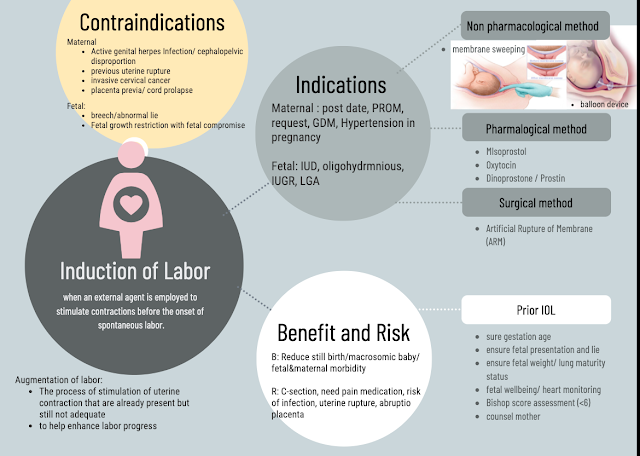 Med4yu: Induction of labor - Obstetric