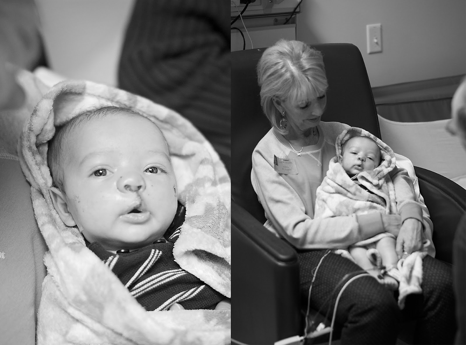 Riley's Story: Riley's lip repair surgery