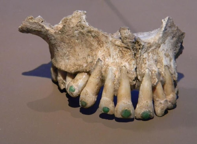 The Mayans Used to Decorate Their Teeth by Place Carved Stone Inlays ...
