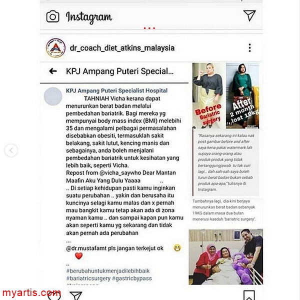 MYARTIS.COM | MYARTIS | MY | ARTIS: "BAGI BUKTI SAYA PERNAH CAKAP TAK OPERATE" - VICHA TERKILAN ...