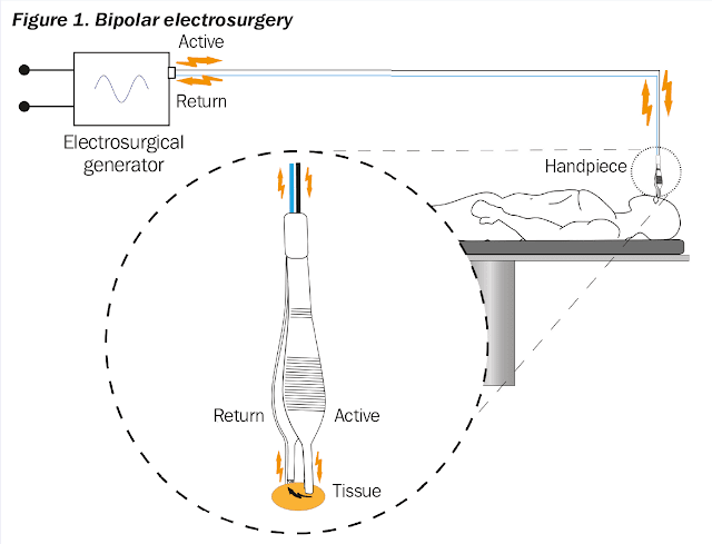 The Site for Healthcare Professionals: Electro Surgical Unit (ESU).