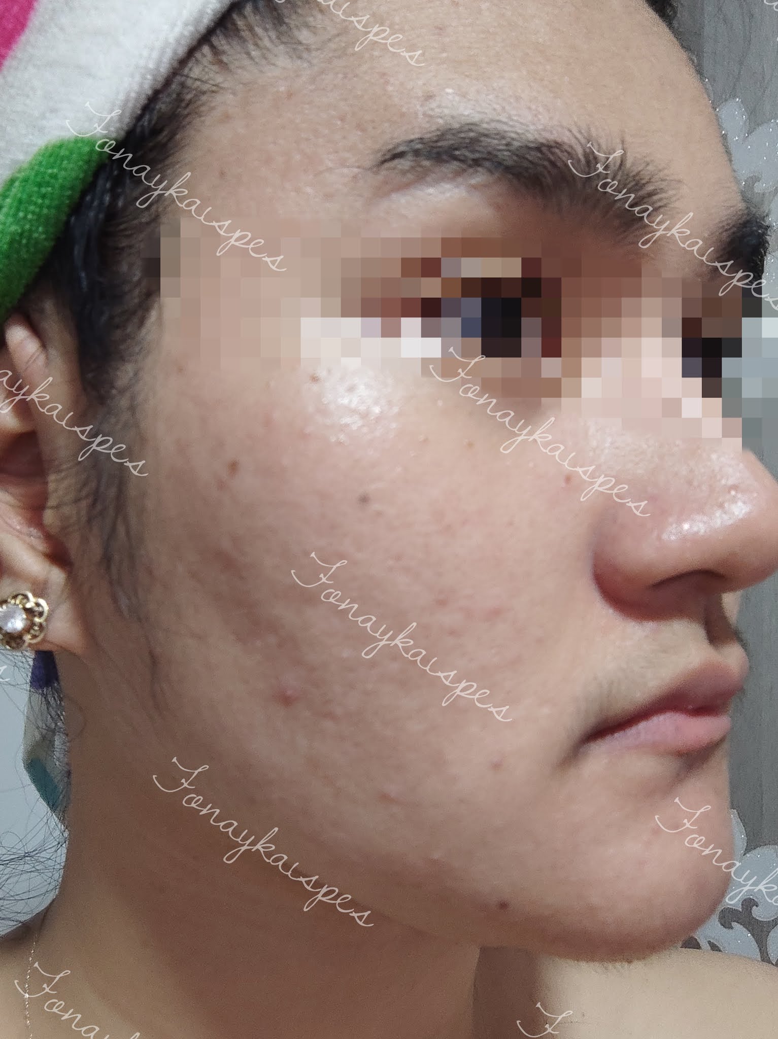 Lionesse Gem Skin Care White Pearl Facial Peeling Review ...