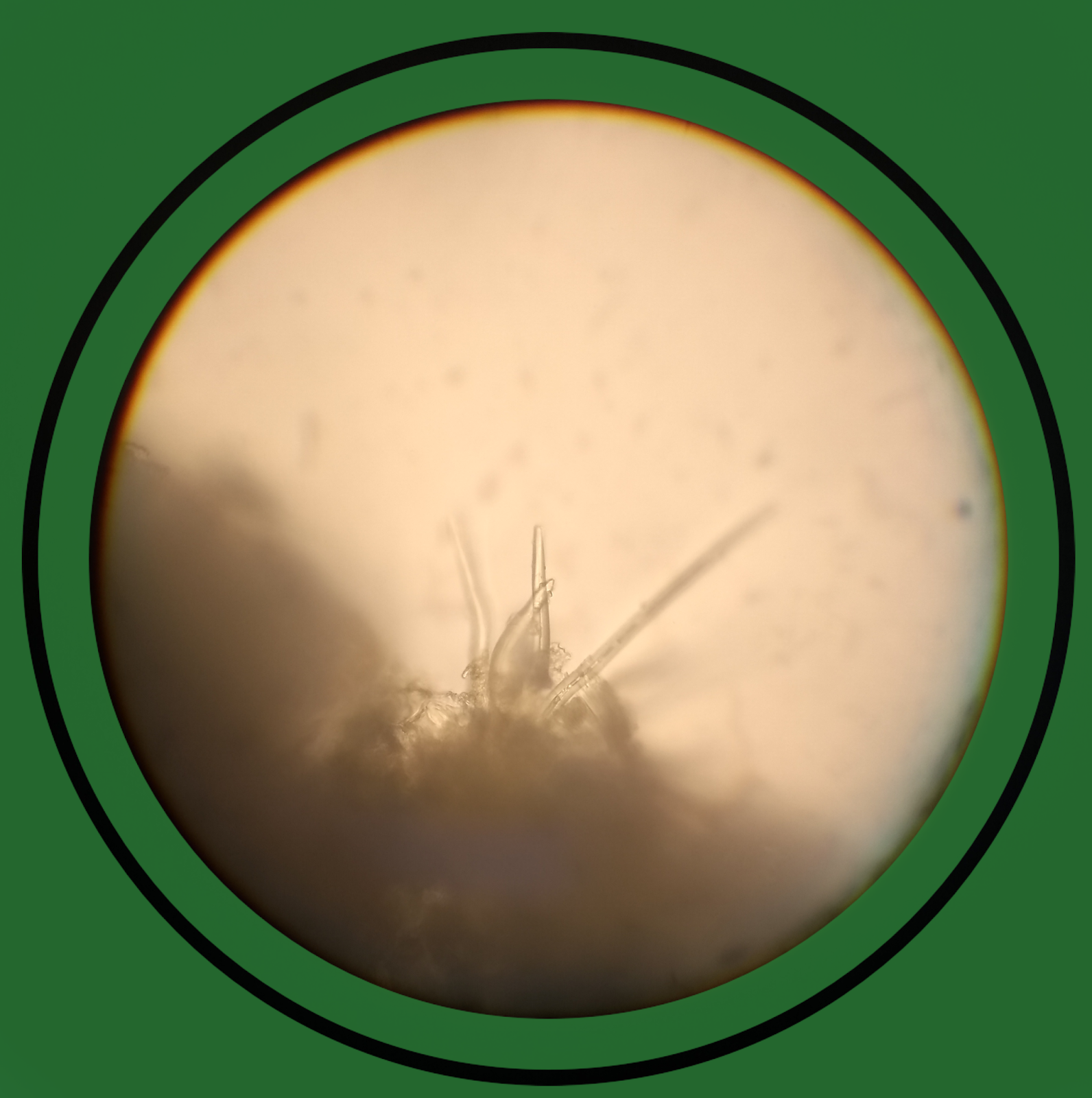 Microbotánica: Anexos epidérmicos: Tricomas