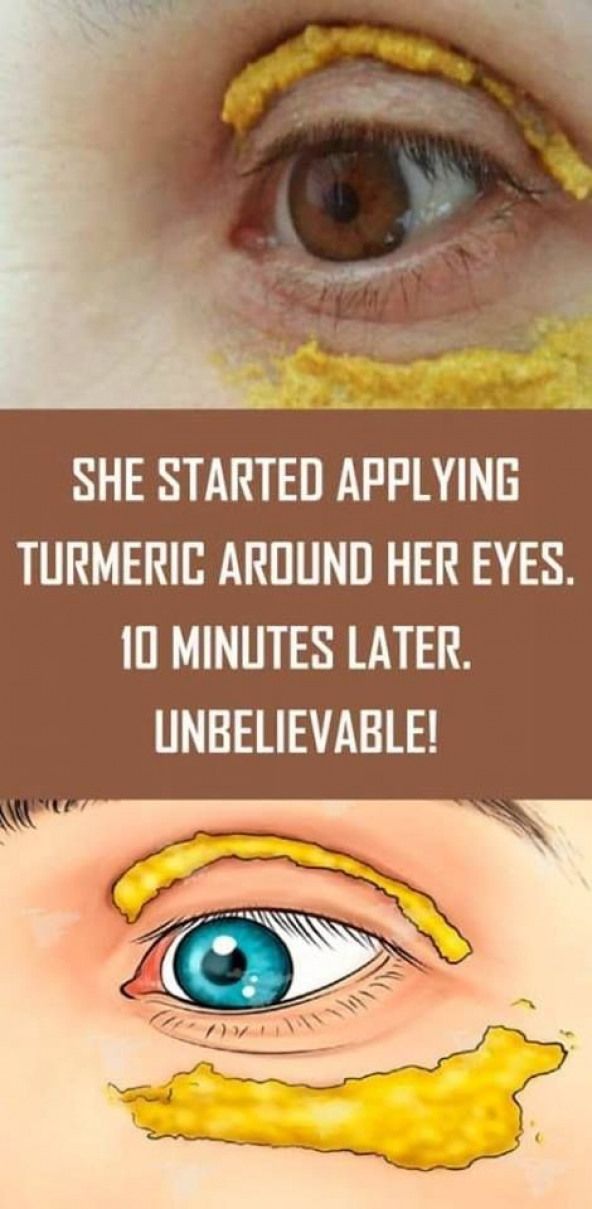 She Started Applying Turmeric Around Her Eyes. 10 Minutes Later ...
