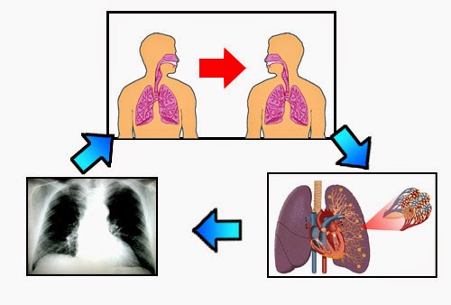LA TUBERCULOSIS: INTRODUCCIÓN DE LA TUBERCULOSIS