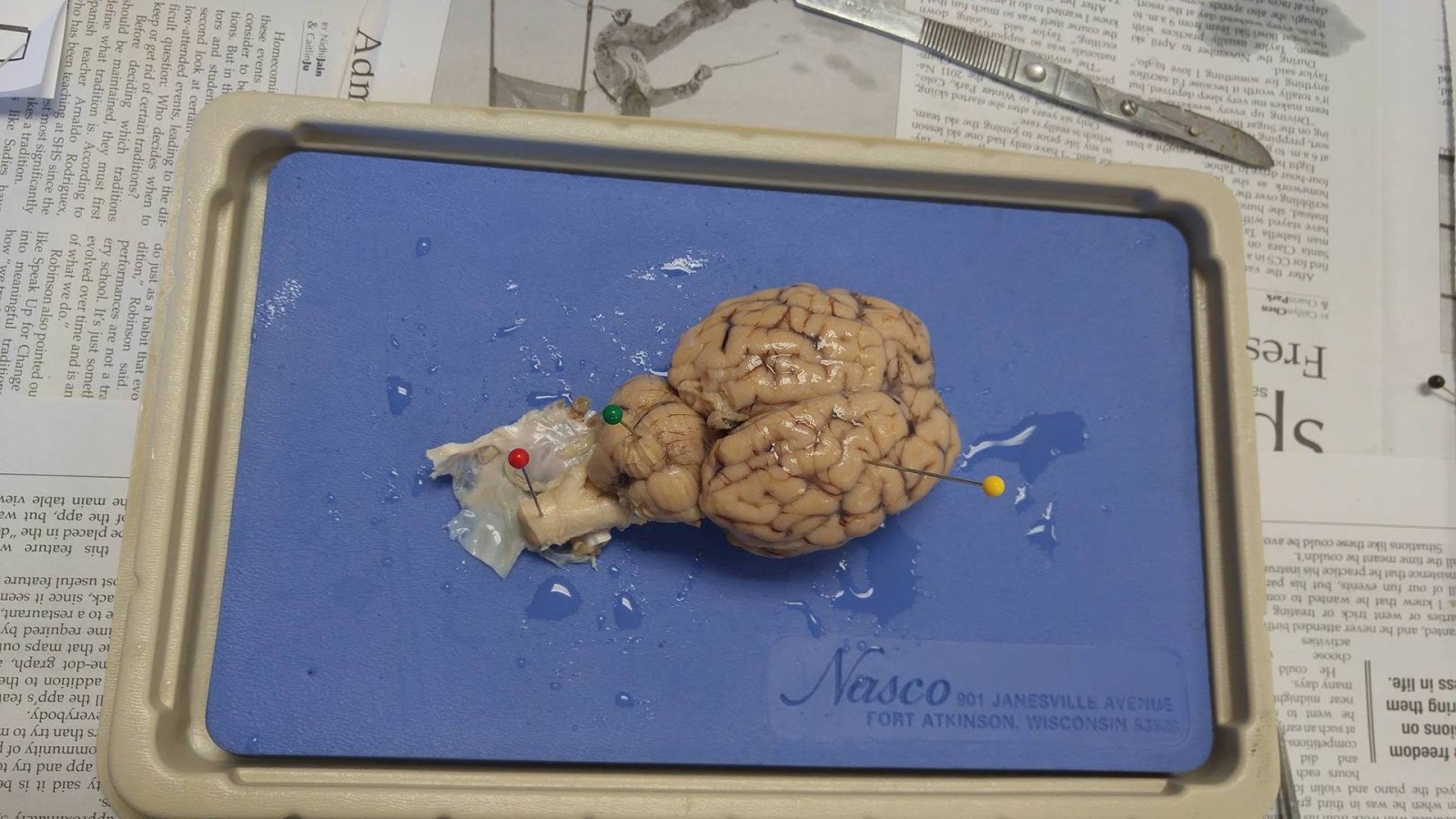 Jackie's 2015 A&P: Brain Dissection