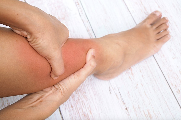 6 Early Signs and Symptoms of Lupus You Should Never Ignore