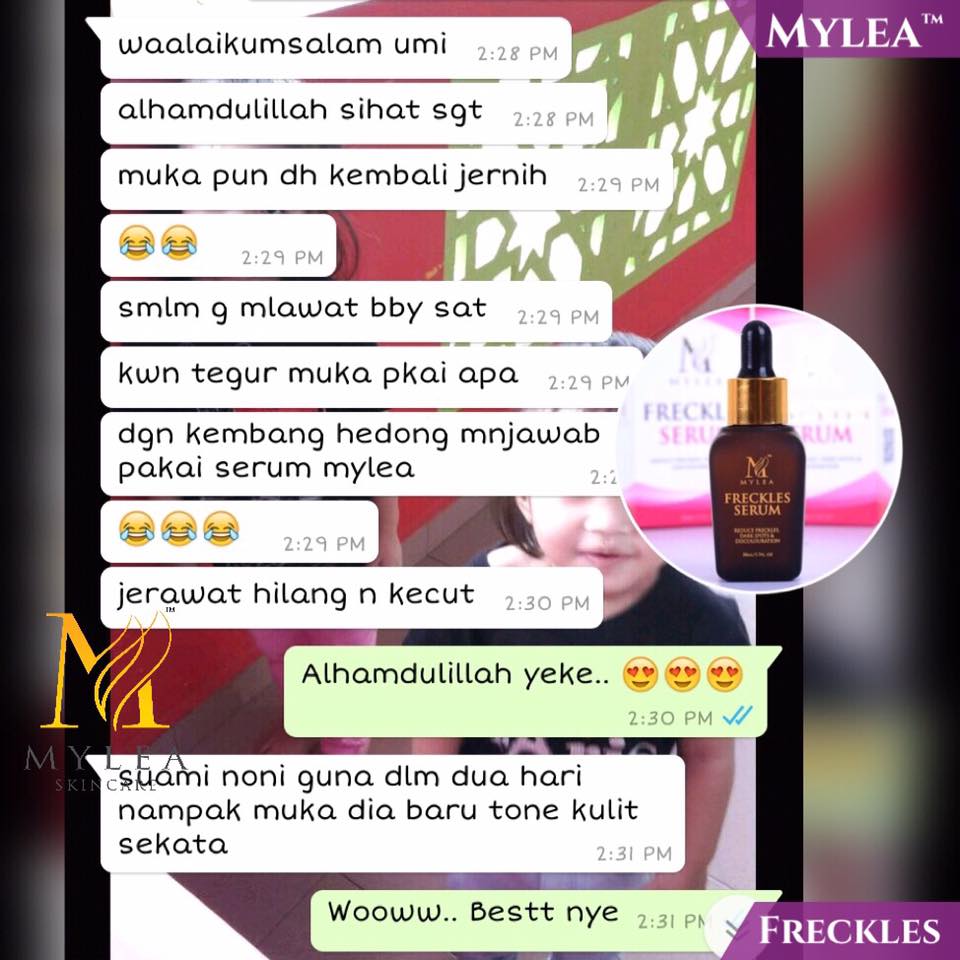 Miss DeL: MYLEA FRECKLES SERUM