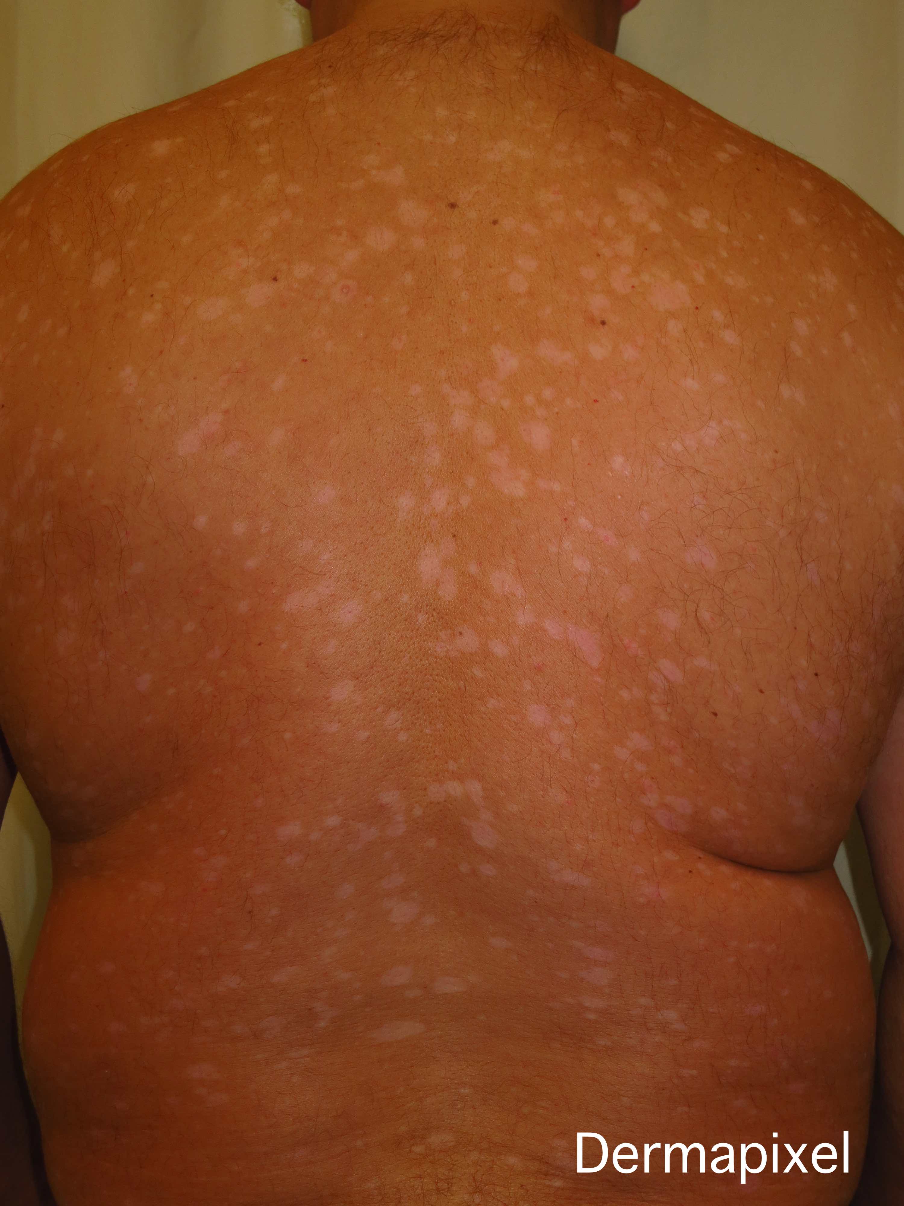 Dermapixel: febrero 2021