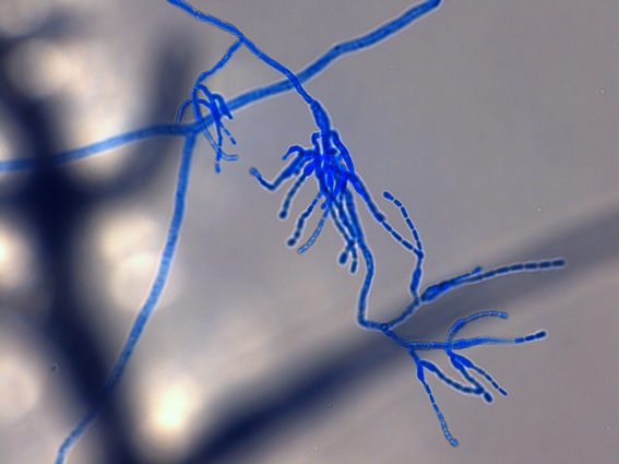 Fun With Microbiology (What's Buggin' You?): Arthrographis species