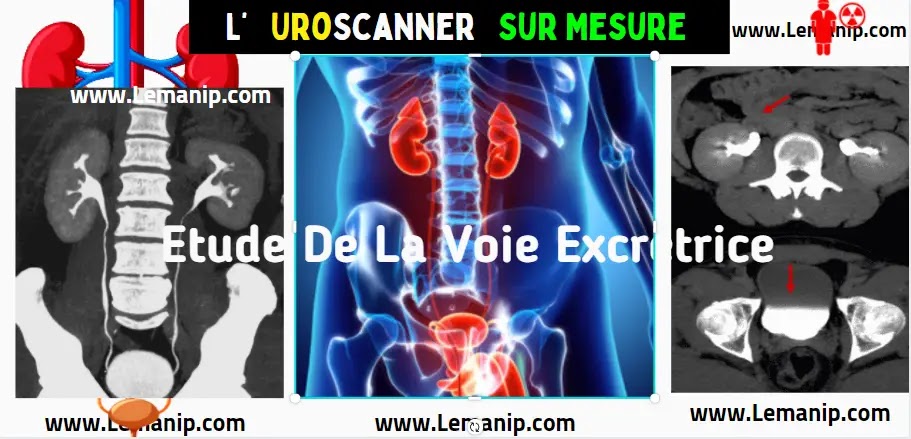 L’UroScanner Sur Mesure : Etude De La Voie Excrétrice