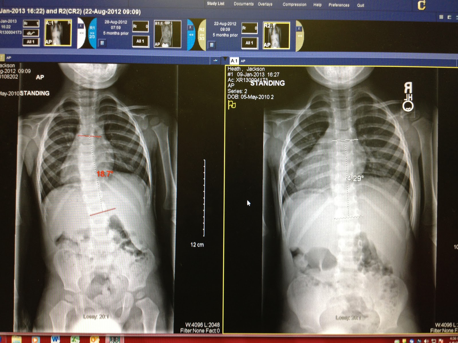 journeys with jax and oliver: Mehta Casting #8; Overjoyed!