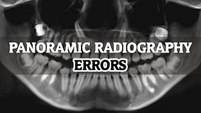 PANORAMIC RADIOGRAPHY: Errors you should not make