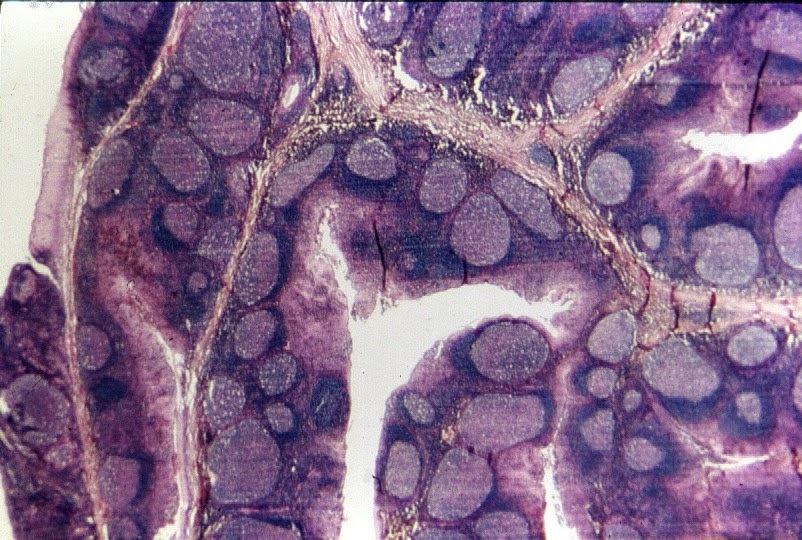 Tejido linfático y órganos linfoides: Tejido linfoide según la histología