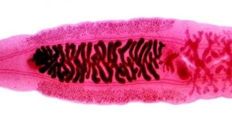 Agent Orange Zone: Liver flukes and bile duct cancer 2017 study ...