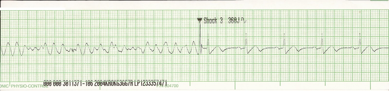 Electrical Interventions